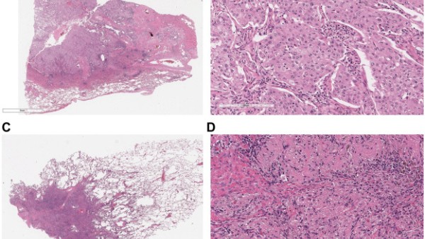 Annual Report 2023 | IASLC