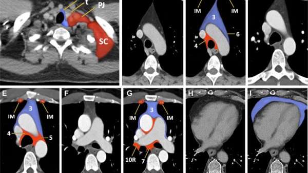 Annual Report 2023 | IASLC