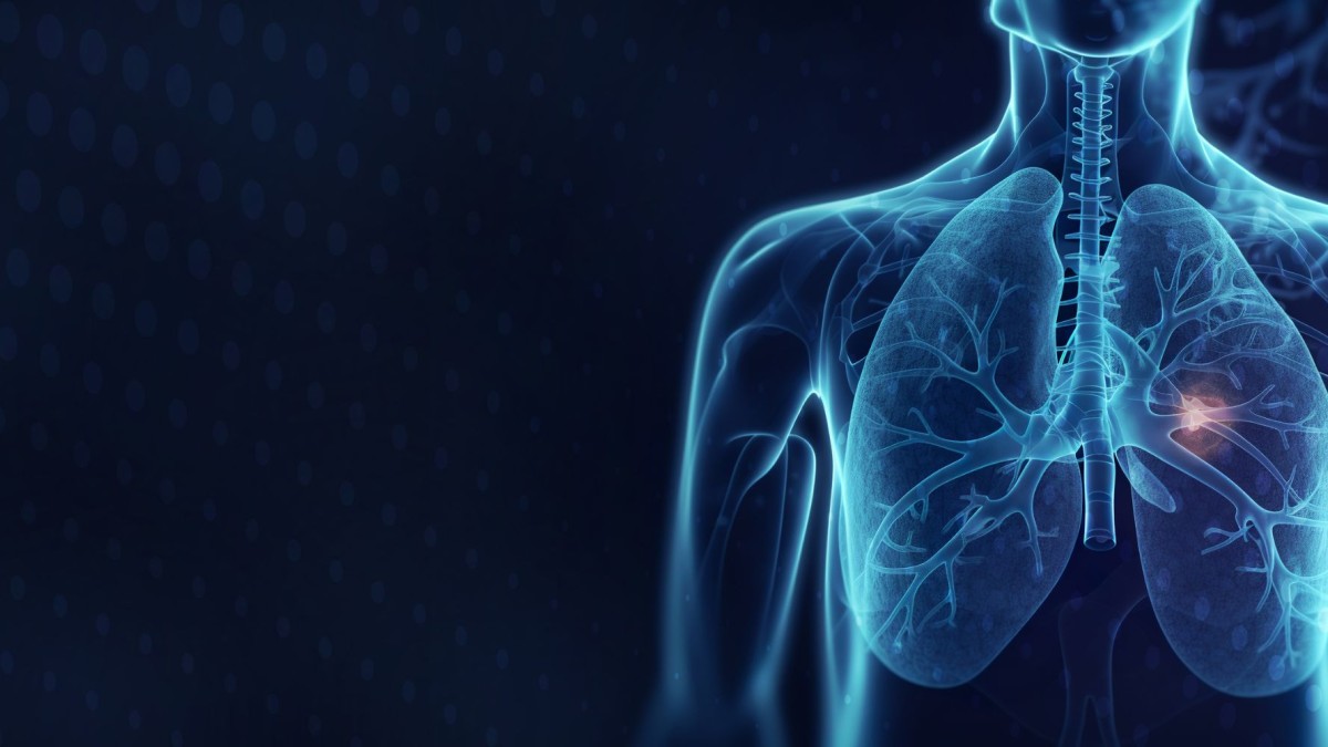 IASLC | International Association for the Study of Lung Cancer