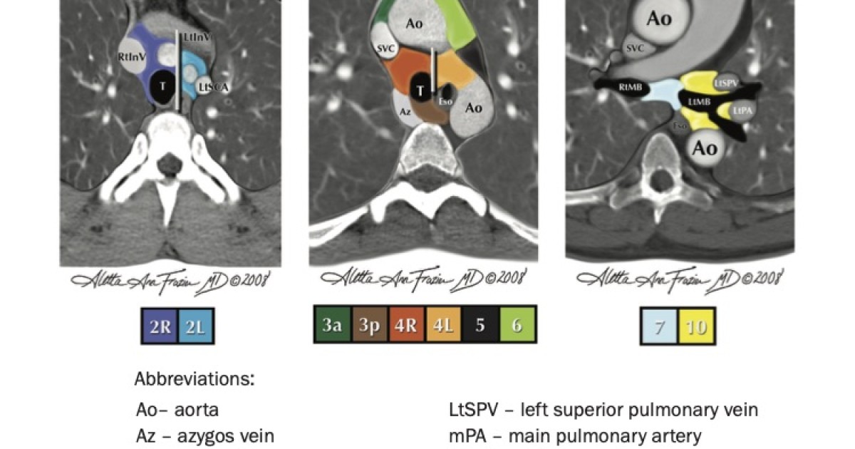 Staging Laminate Reference Cards, 8th Edition | IASLC
